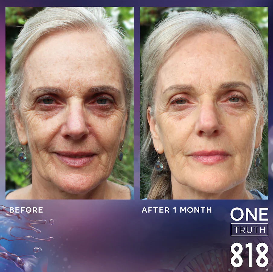 Can You relate With Felicity? – One Truth 818 Australia